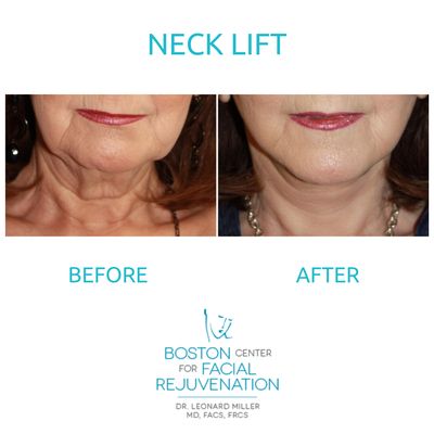 BOSTON CENTER FOR PLASTIC SURGERY - Updated January 2026 - 102 Photos ...