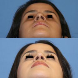 EVAN RANSOM, MD - 123 Photos & 171 Reviews - Cosmetic Surgeons - 450 ...