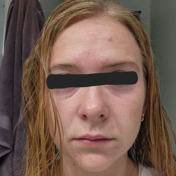 HI, SKIN - Updated September 2025 - 58 Photos & 74 Reviews - 100 E ...