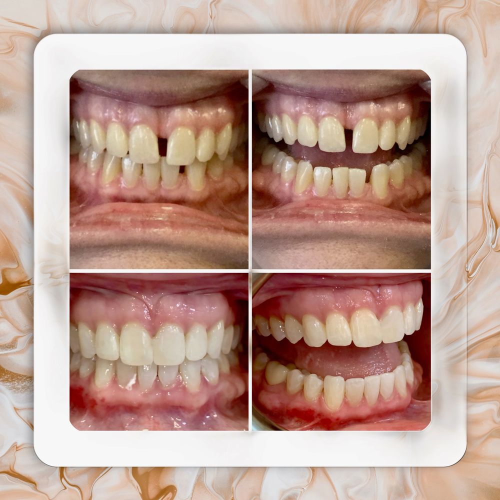 JOHNS CREEK DENTAL ASSOCIATES - Updated October 2025 - 53 Photos & 106 ...