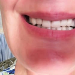 CATALINA SMILES DENTISTRY - 16 Photos & 55 Reviews - 7645 N Oracle Rd ...