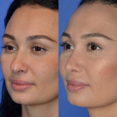 ASHKAN GHAVAMI, MD - Updated December 2025 - 242 Photos & 165 Reviews ...