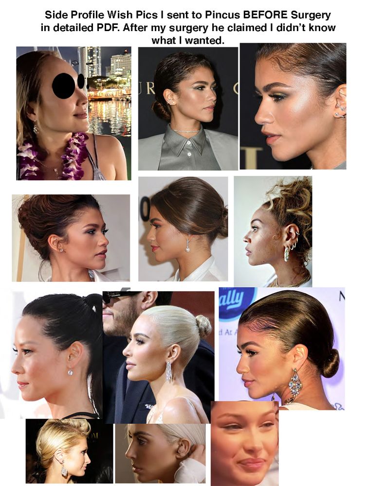 STEPHEN J PINCUS, MD, FACS - Updated November 2025 - 39 Photos & 27 ...