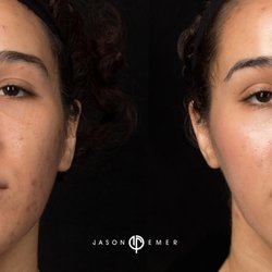 JASON EMER, MD - 914 Photos & 365 Reviews - Dermatologists - 9201 ...
