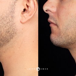 JASON EMER, MD - 914 Photos & 365 Reviews - Dermatologists - 9201 ...