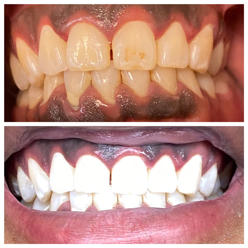 SPARKLING WHITE SMILES - ATLANTA - Updated July 2025 - 96 Photos - 2900 ...