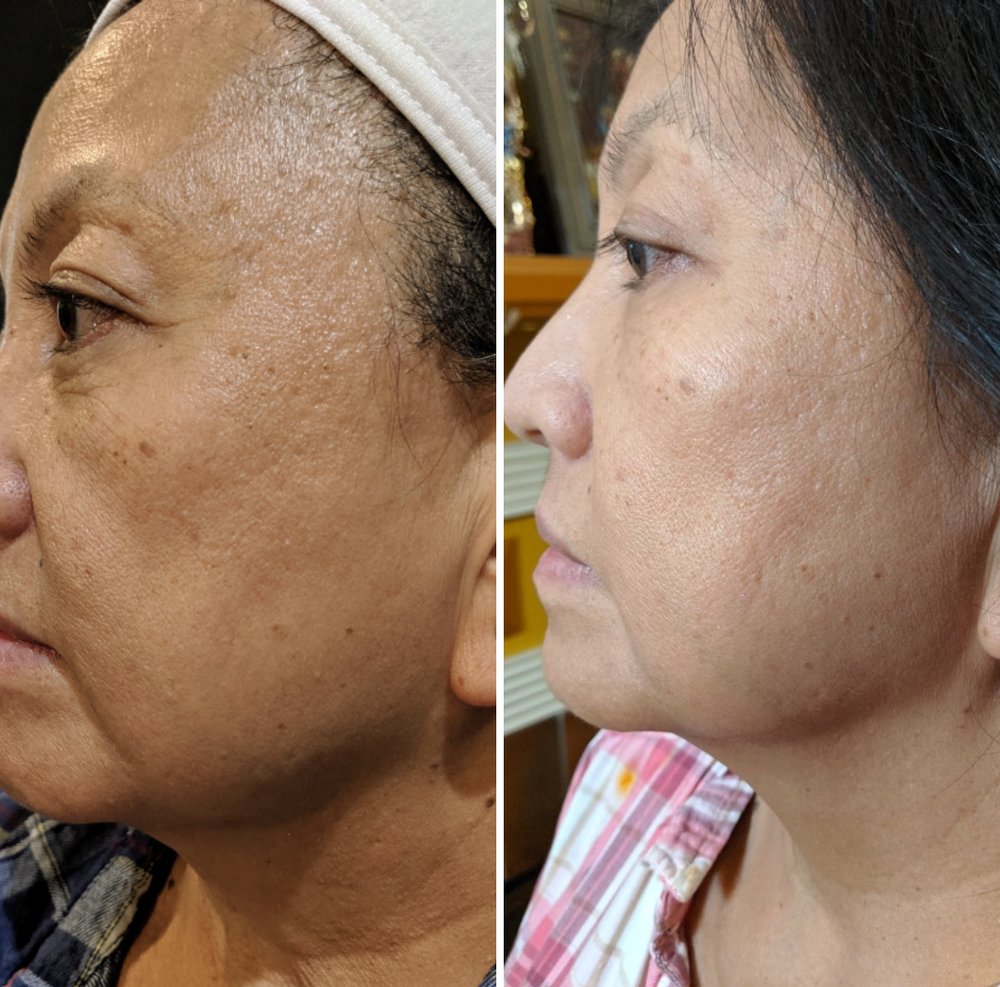 NEW MOON ESTHETICS - 21 Photos - 1045 Park Ave, San Jose, California ...