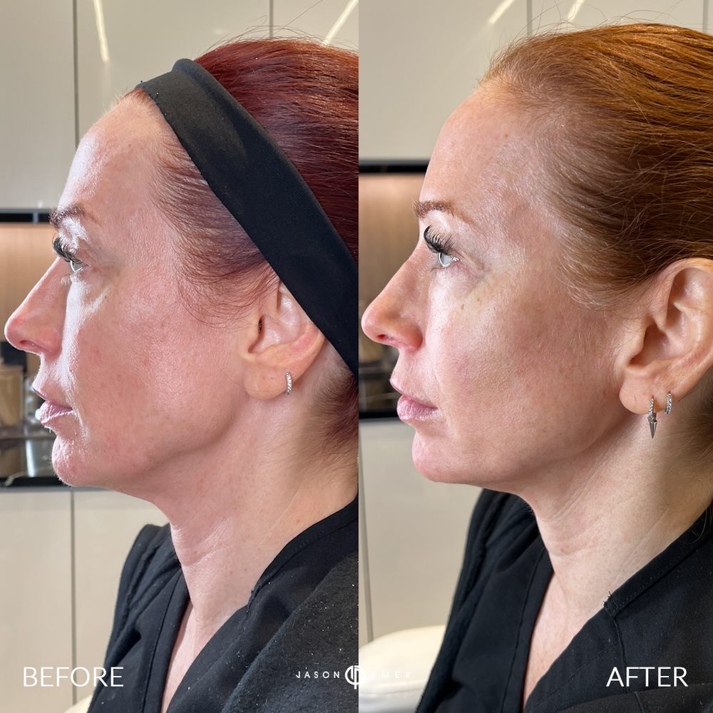 JASON EMER, MD - Updated November 2024 - 1053 Photos & 492 Reviews ...