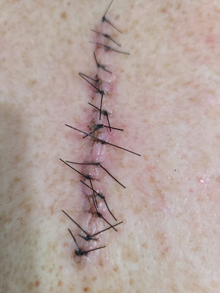 MIDWEST CENTER FOR DERMATOLOGY & COSMETIC SURGERY - CLINTON TWP ...