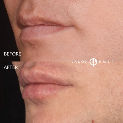 JASON EMER, MD - 995 Photos & 396 Reviews - 9201 Sunset Blvd, West ...