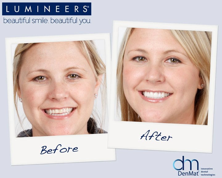 ANTHONY CECCACCI DDS, MADISON AVENUE SMILES - Updated December 2025 ...