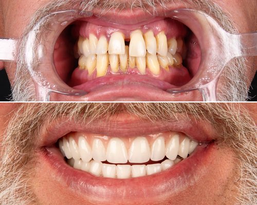 SMILE BUILDERS - Updated October 2025 - 138 Photos & 114 Reviews - Av ...