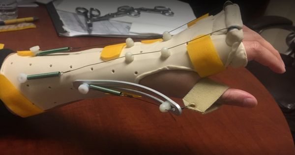 PRECISION REHAB OCCUPATIONAL PHYSICAL & HAND THERAPY - Updated December ...