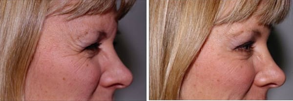 KIMBERLY COCKERHAM, MD - Updated August 2025 - 30 Photos & 13 Reviews ...