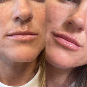 PLUSH MED SPA - 44 Photos & 101 Reviews - 2087 Ventura Blvd, Camarillo ...