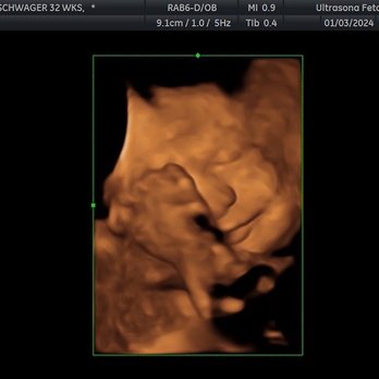 ULTRASONA FETAL FOTOS - Updated December 2025 - 27 Photos & 44 Reviews ...