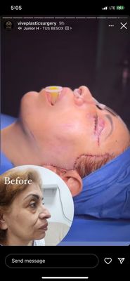 VIVE PLASTIC SURGERY - Updated December 2025 - 76 Photos & 83 Reviews - Av Salvador Novo 1060 ...