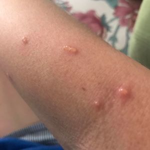 NORTH BEACH - 207 Photos & 46 Reviews - Beaches - Miami Beach, FL