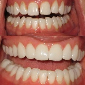 SIMI VALLEY DENTAL GROUP AND ORTHODONTICS - Updated March 2025 - 25 ...