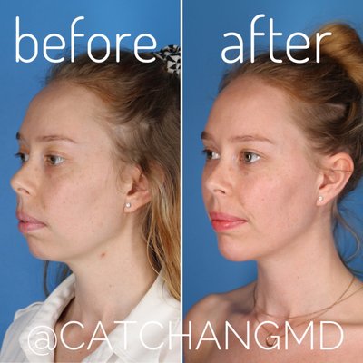 CATHERINE CHANG - Updated December 2025 - 13 Photos & 35 Reviews - 9735 ...