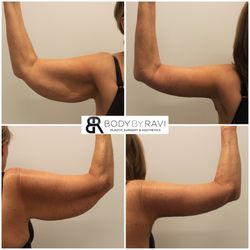 BODY BY RAVI PLASTIC SURGERY AND AESTHETICS - 125 Photos & 23 Reviews ...