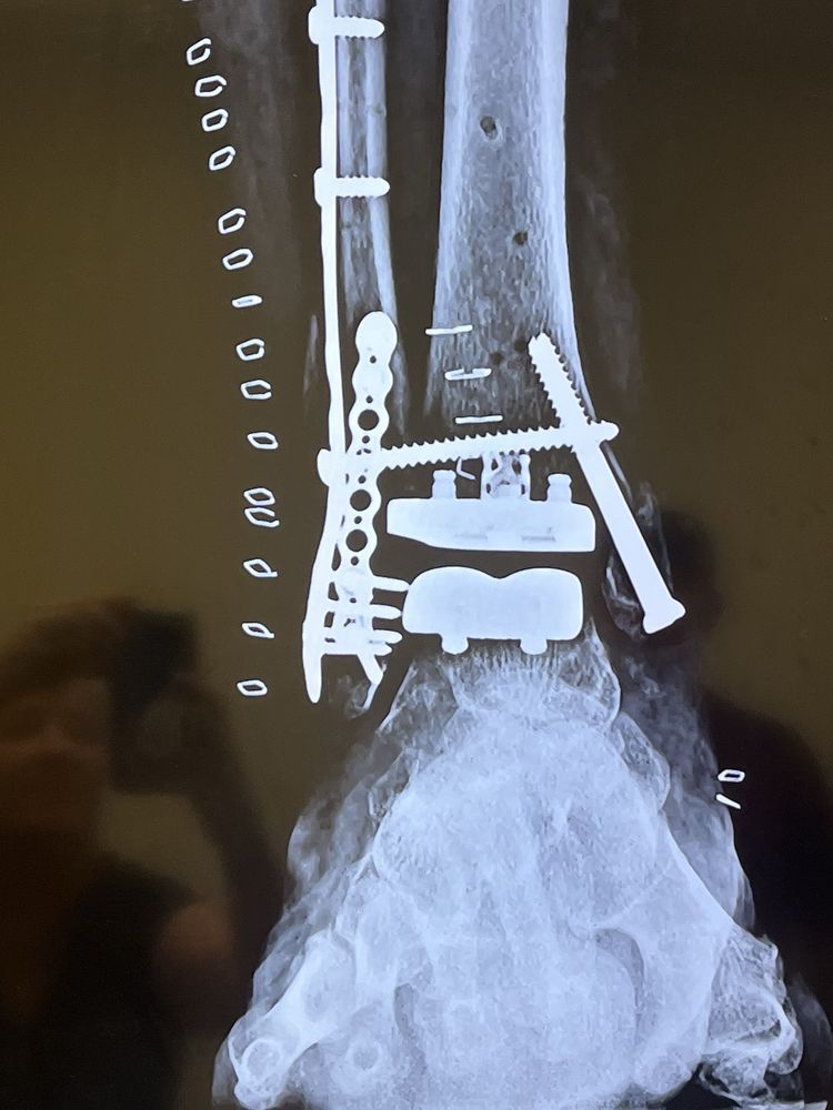 PHOENIX FOOT AND ANKLE INSTITUTE - Updated August 2025 - 13 Reviews ...