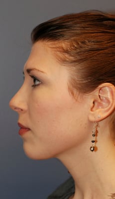 SAMUEL LIN, MD, FACS - Updated December 2025 - 30 Photos - 98 Binney St ...