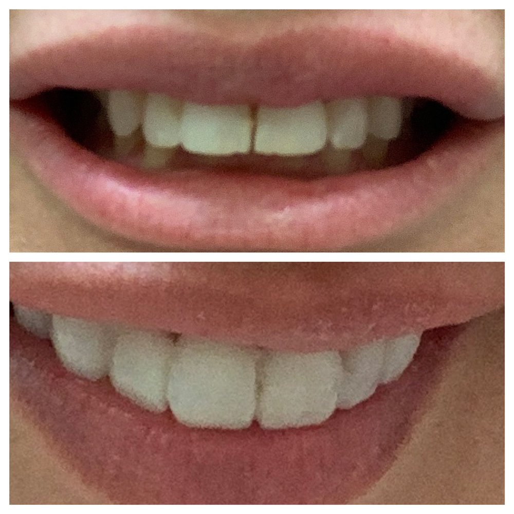 SIGNATURE SMILES DENTAL CARE - 26 Photos & 43 Reviews - 1128 Lake St ...