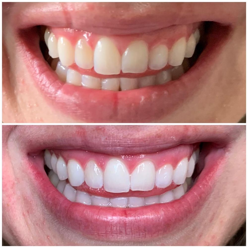 BRITESMILE - Updated August 2024 - 832 E 800 N, Orem, Utah - Teeth ...