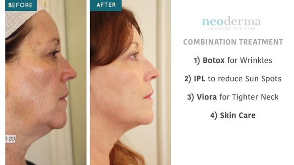 NEODERMA - Updated December 2025 - 478 Photos & 307 Reviews - 1175 E ...