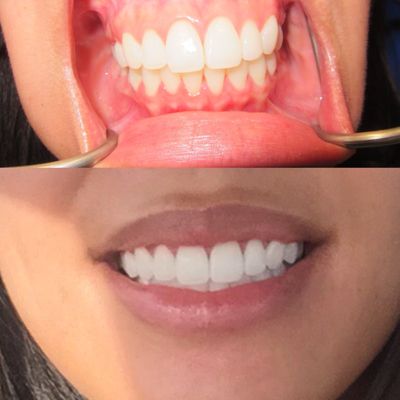 CALIFORNIA SMILE - Updated January 2026 - 113 Reviews - 620 Contra ...