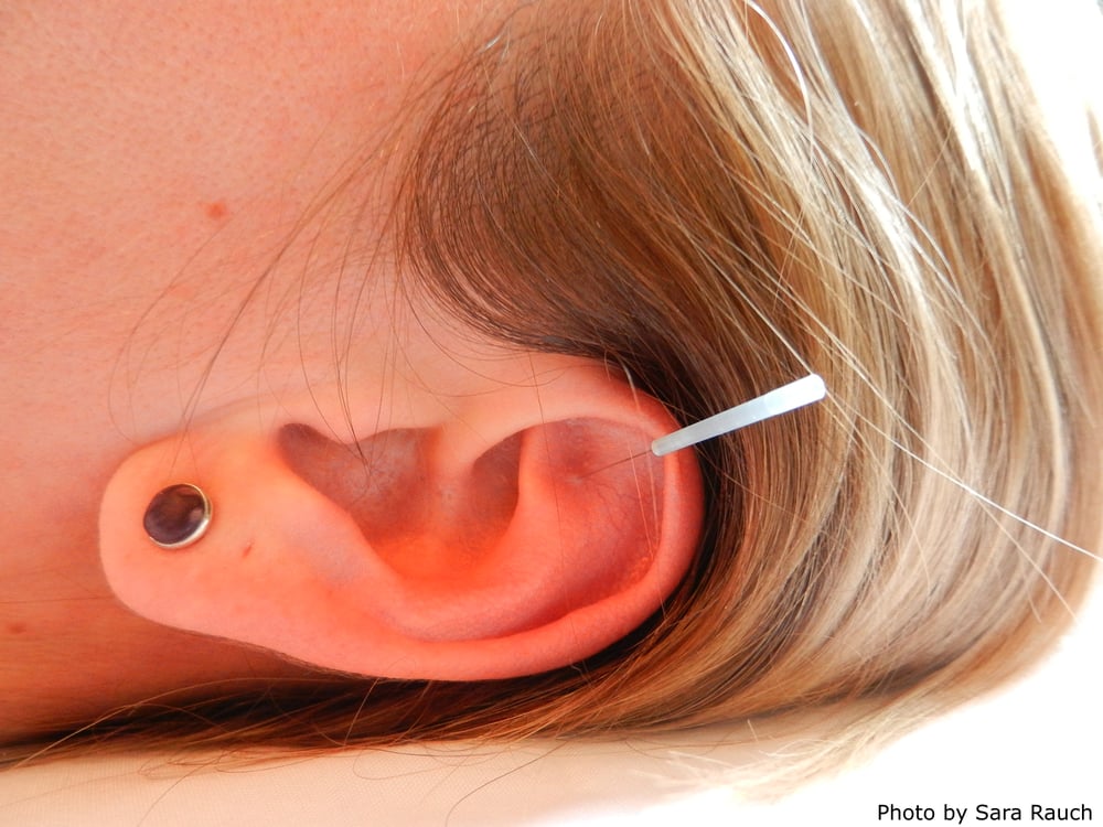 WINDOW OF HEAVEN ACUPUNCTURE & YOGA - Updated December 2024 - 65D Elm ...