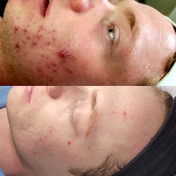 AZ SKIN REHAB - Updated December 2025 - 69 Photos & 71 Reviews - 930 ...