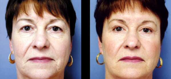 JOSEPH R BARNTHOUSE, MD - Updated May 2025 - 47 Photos - 1010 ...