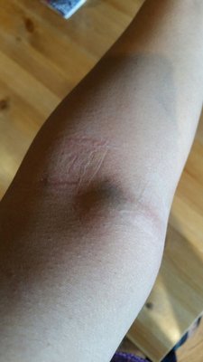 LABCORP - Updated December 2025 - 10 Photos & 23 Reviews - 307 Hamburg ...