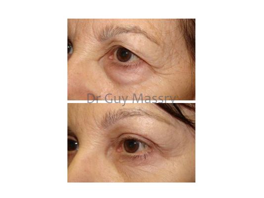 GUY MASSRY, MD - Updated December 2025 - 154 Photos & 176 Reviews - 150 ...