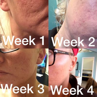 REVITALIGHT THERAPY & SKINCARE - Updated December 2024 - 1915 Greenview ...