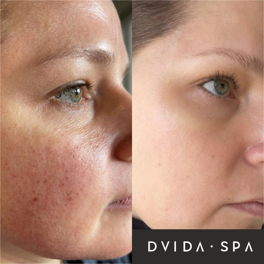 DVIDA MED SPA - 138 Photos & 279 Reviews - 507 N Wells St, Chicago ...