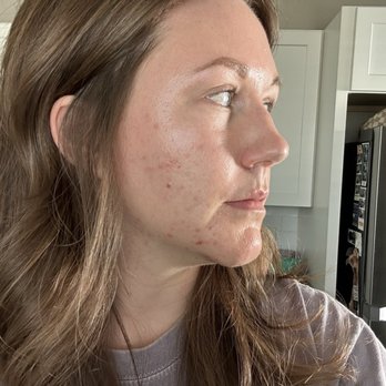 HI, SKIN - Updated September 2025 - 58 Photos & 74 Reviews - 100 E ...