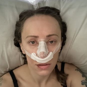 DRMICHAELKIM FACIAL PLASTIC SURGERY - Updated July 2025 - 18 Photos ...