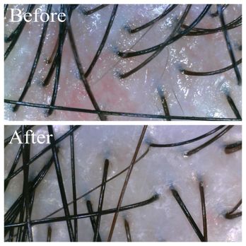 COSH HEAD SPA - Updated January 2026 - 51 Photos & 117 Reviews - 401 ...