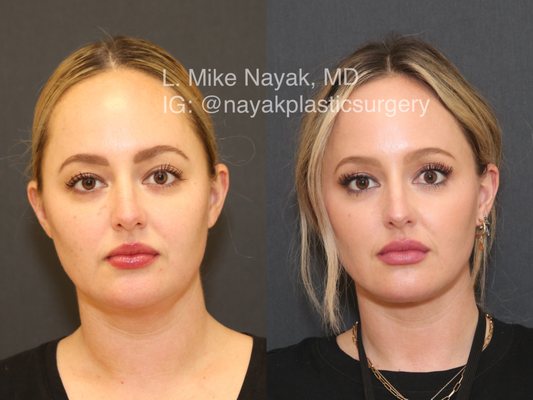 NAYAK PLASTIC SURGERY - Updated March 2025 - 266 Photos & 33 Reviews ...