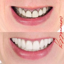 THOMAS CONNELLY, DDS - 44 Photos & 22 Reviews - 450 N Roxbury Dr ...