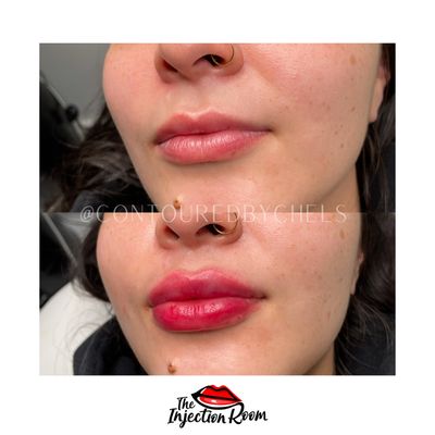 THE INJECTION ROOM - Updated December 2025 - 139 Photos & 60 Reviews ...