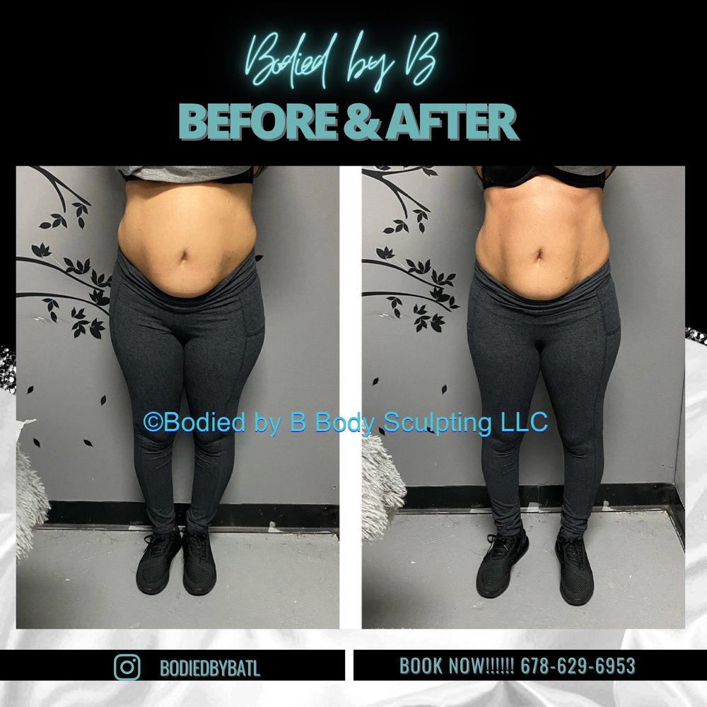 BODIED BY B BODY SCULPTING - Updated April 2025 - 12 Photos - 2135 E ...