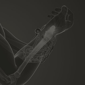 SANTA ROSA ORTHOPAEDICS - Updated May 2025 - 12 Reviews - 34 Mark W ...