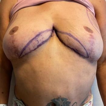 Avana plastic surgery store