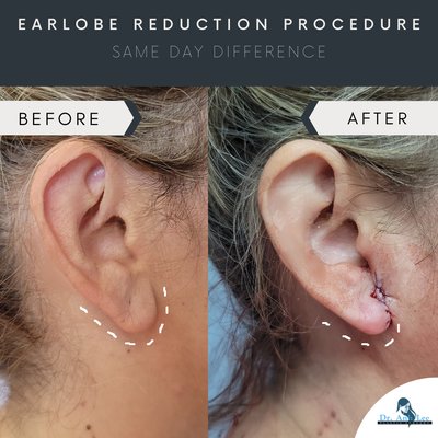 ANH LEE PLASTIC SURGERY - Updated July 2025 - 34 Photos & 15 Reviews ...