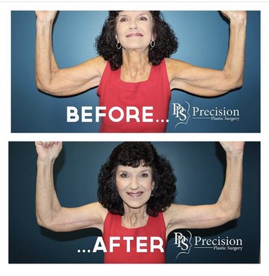 PRECISION PLASTIC SURGERY - Updated May 2026 - 80 Photos & 102 Reviews ...