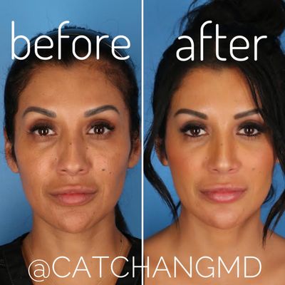 CATHERINE CHANG - Updated December 2025 - 13 Photos & 35 Reviews - 9735 ...